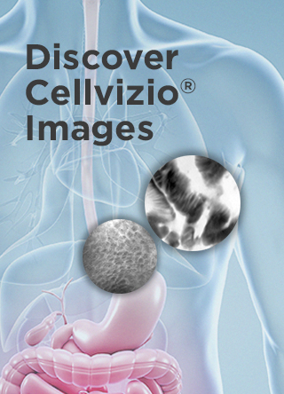 Cellvizio